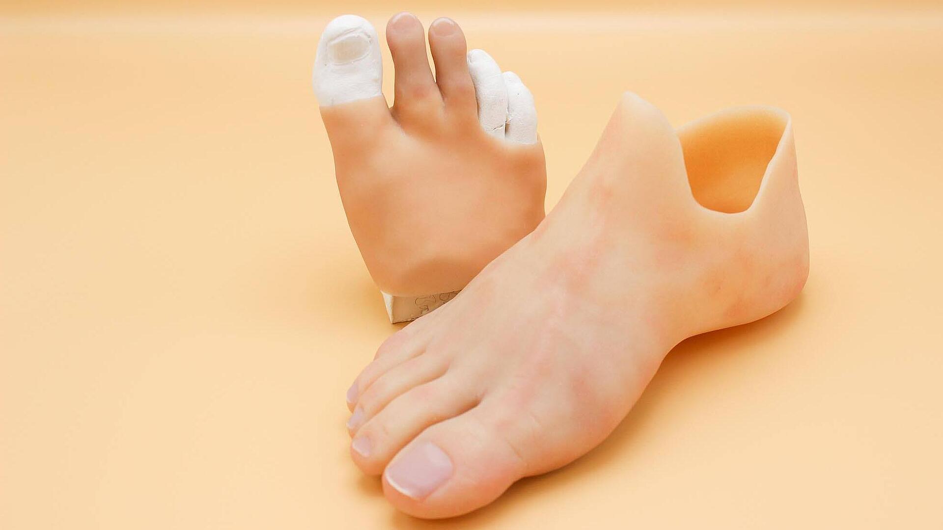 Prothesen für untere Extremitäten - ORD